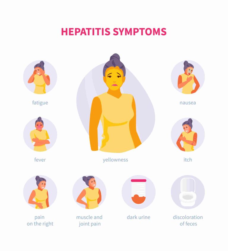 These are the general symptoms of Hepatitis in people experienced who ...