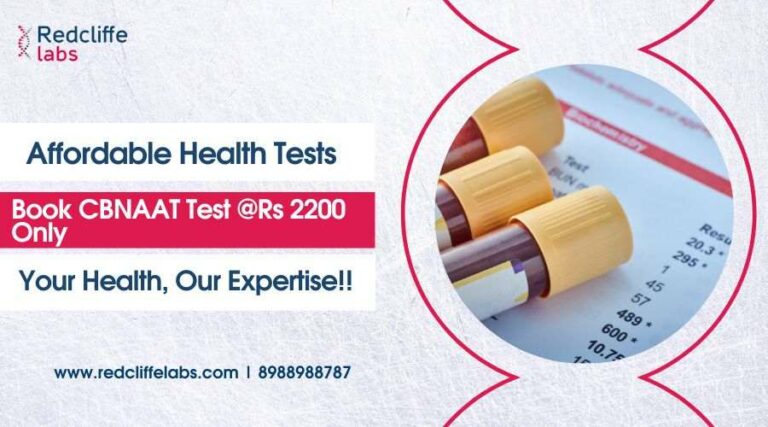CBNAAT Test Price in Different Cities