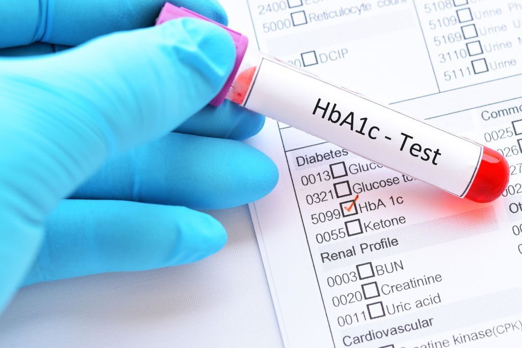 Hba1c Conversion Chart Mmol Moles - Infoupdate.org